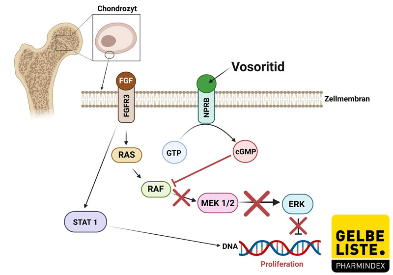 Neueinführung Voxzogo bei Achondroplasie | Gelbe Liste